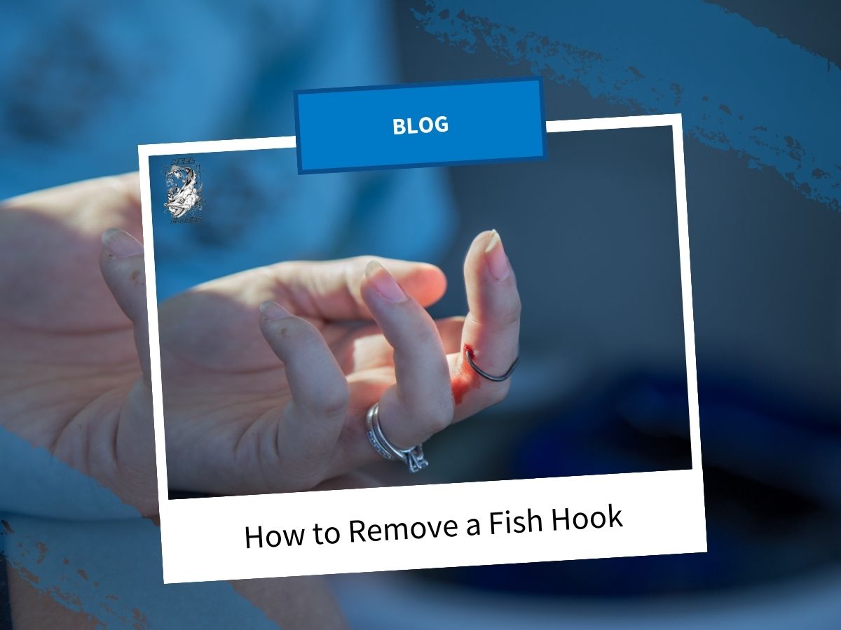 Essential Fish Hook Removal Guide for Anglers